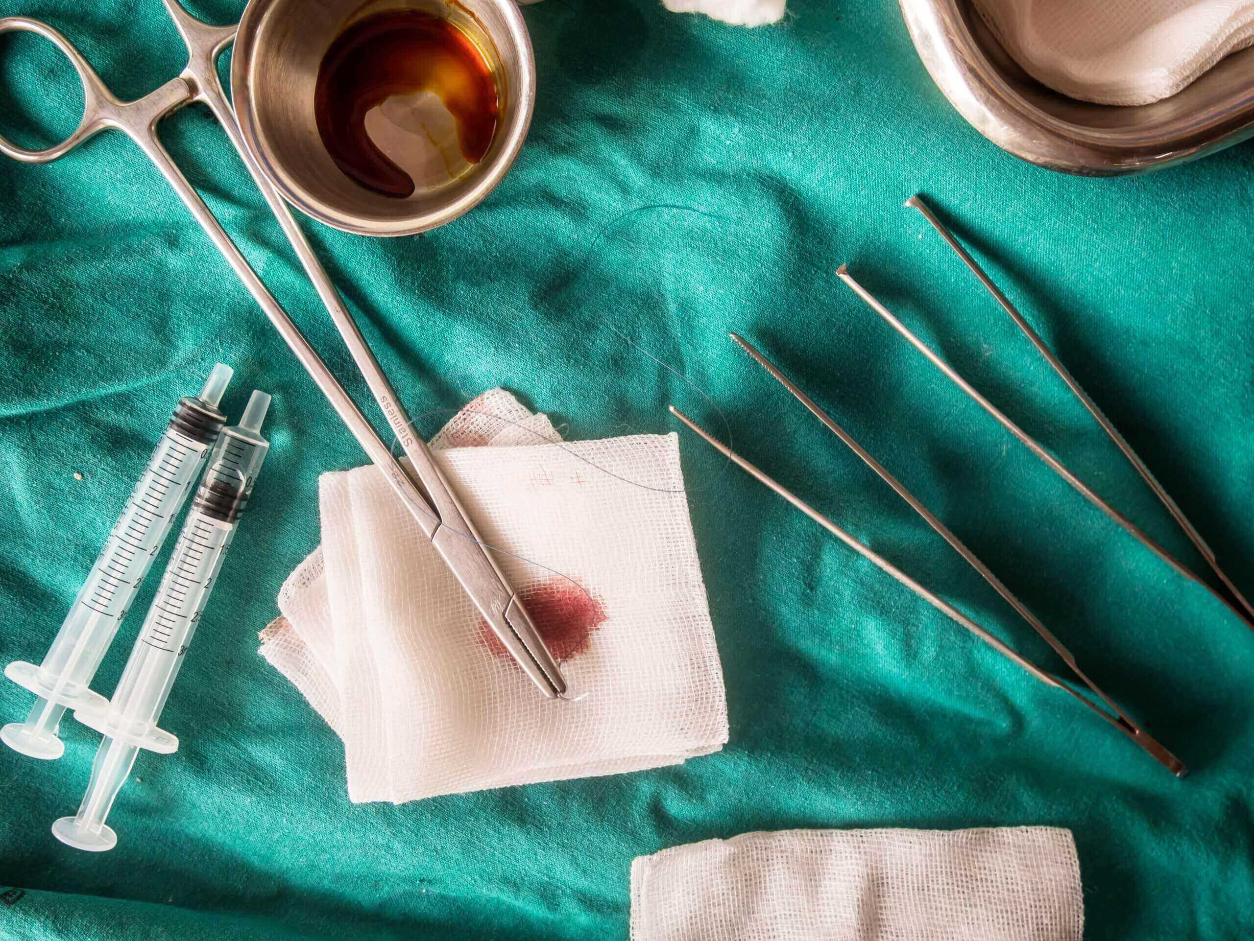 Minor Surgical Procedures: Definition, Types, and Importance